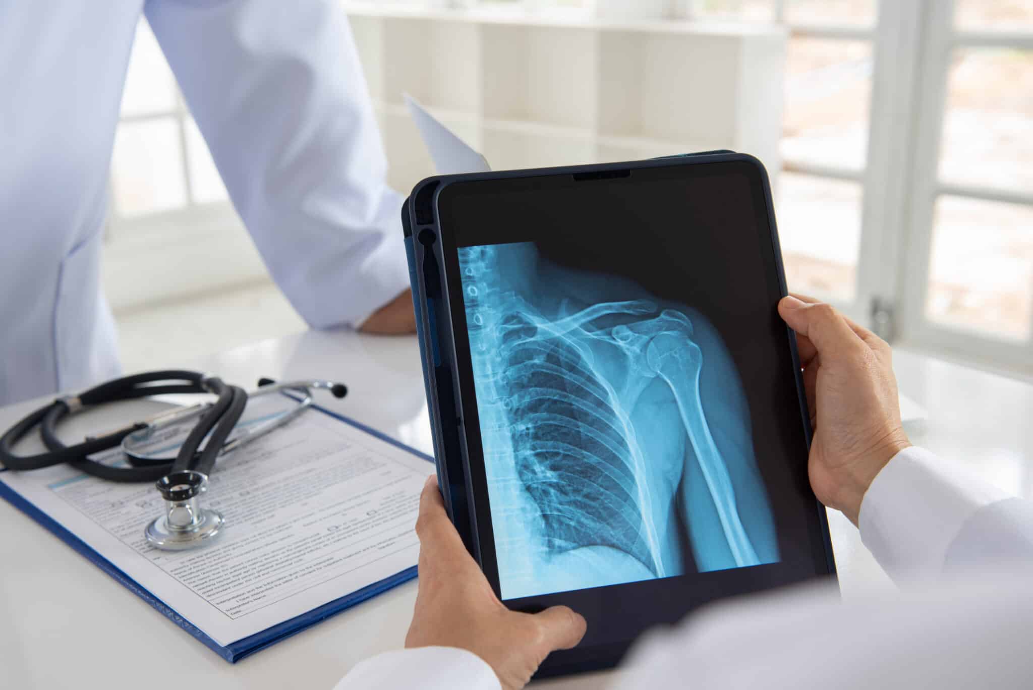 How Maximum Medical Improvement Impacts Your Claim | Emery Reddy